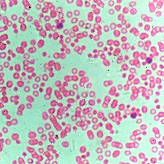 Preparación microscópica de muestra de sangre | Zeigen